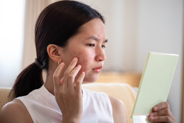 10 Best Retinol Products in the Philippines 2026 | Buying Guide ...
