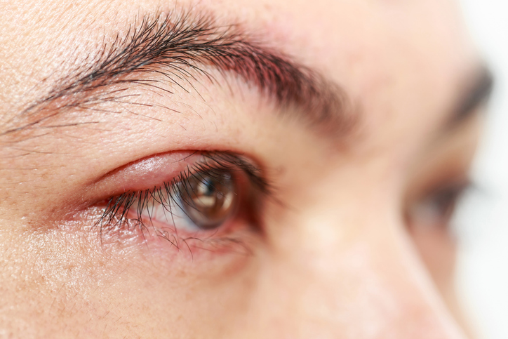 10 Best Eye Drops for Stye in the Philippines 2026 | Systane, EO, and ...